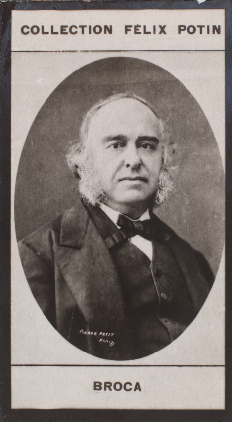 Paul Broca - Pierre Lanith Petit | Musée d'Orsay